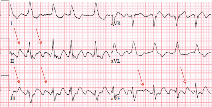 ECG 7 | SpringerLink