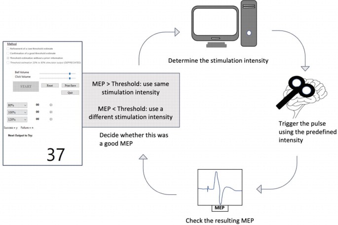 Closed-Loop TMS | SpringerLink
