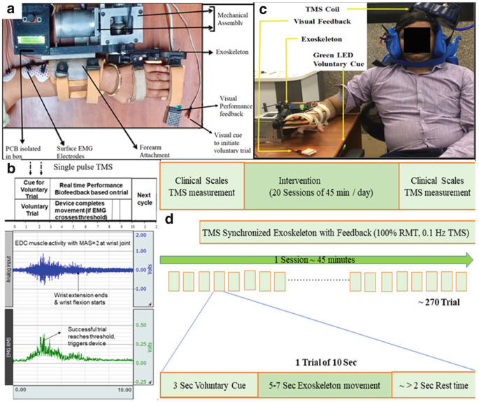 Closed-Loop TMS | SpringerLink