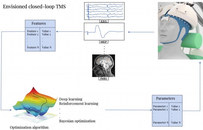 Closed-Loop TMS | SpringerLink