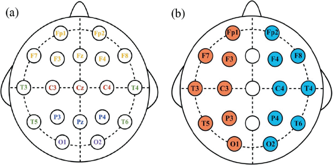 Analysis of SVD Entropy Variability in EEG: Impact of Arithmetic ...