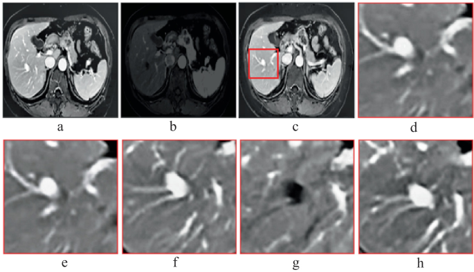 GAN-Enhanced Abdominal MR-CT Image Fusion in Transform Domain ...