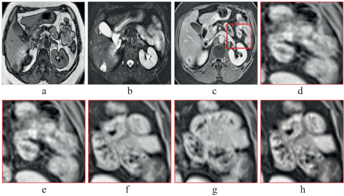 GAN-Enhanced Abdominal MR-CT Image Fusion in Transform Domain ...