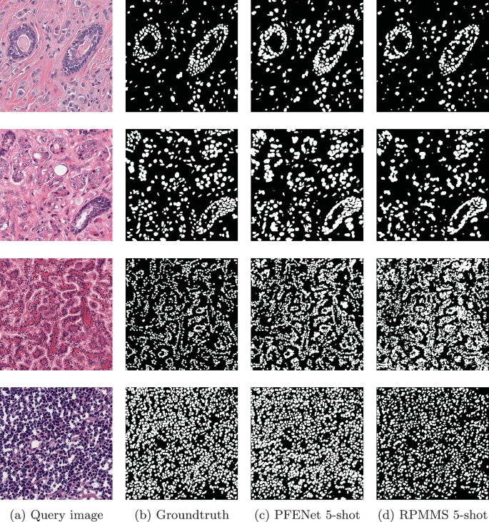 Harnessing Few-Shot Learning Segmentation for Histopathology: A Comprehensive Practical Study ...
