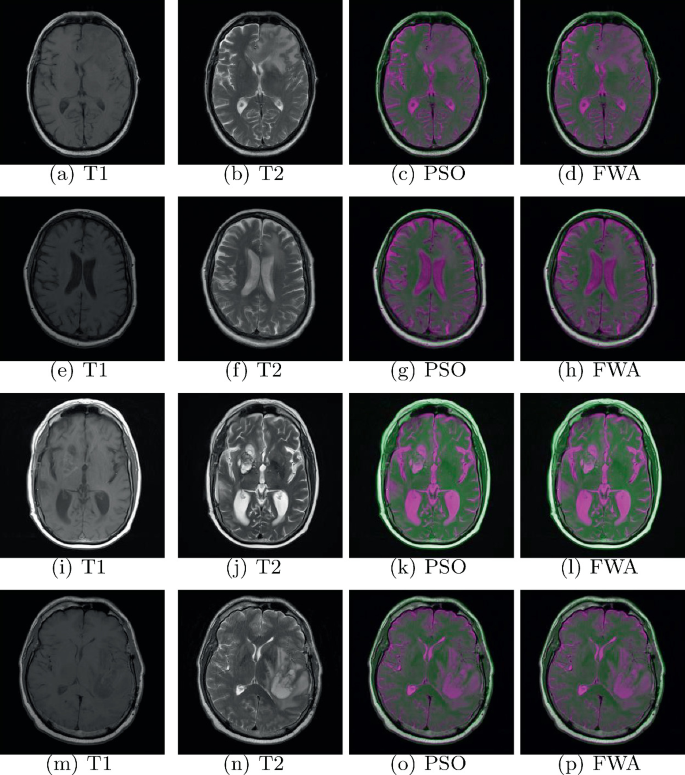 Brain MRI Registration Using Fireworks Algorithm | SpringerLink