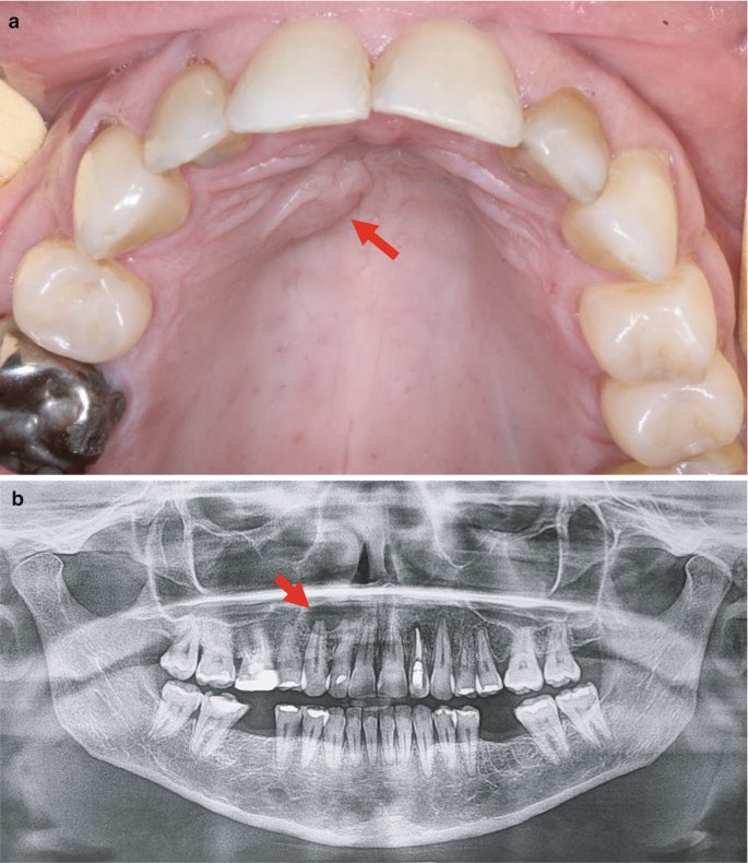 Dental and Periodontal Inflammatory Diseases | Springer Nature Link