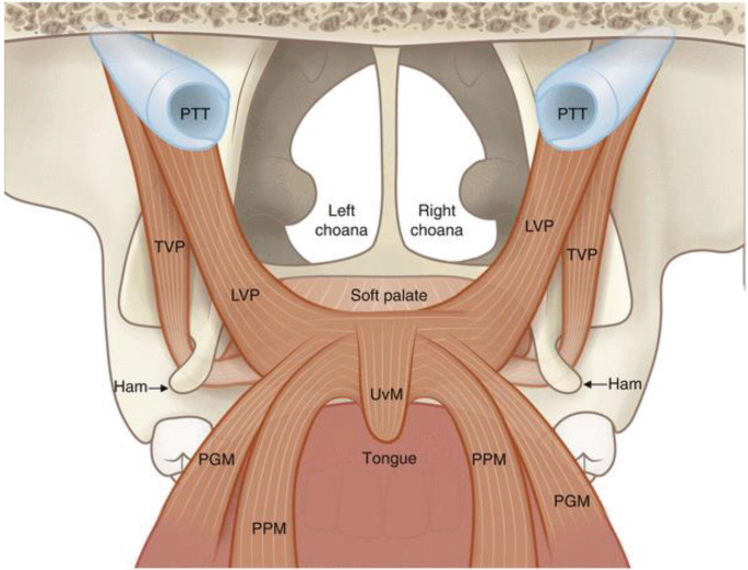 Velopharyngeal Dysfunction | SpringerLink