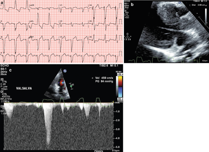 Longitudinal Case-Based Presentations in HCM | SpringerLink
