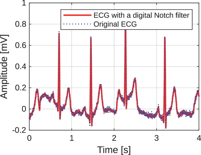 Streamlined Signal Processing for Electrocardiogram ECG | SpringerLink