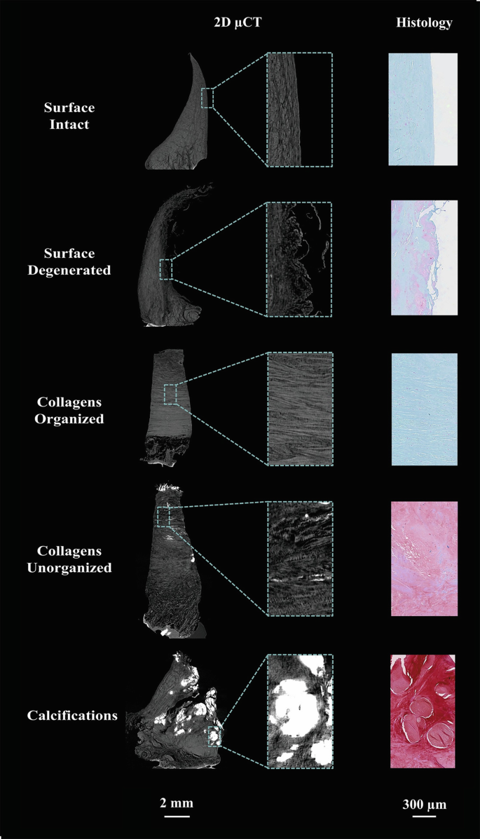 3D Histopathology of Musculoskeletal Tissues Using Contrast-Enhanced ...