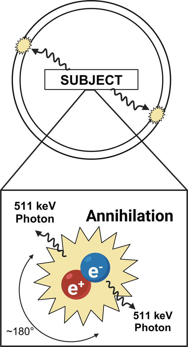 Fundamentals of Positron Emission Tomography (PET) and Its Integration ...