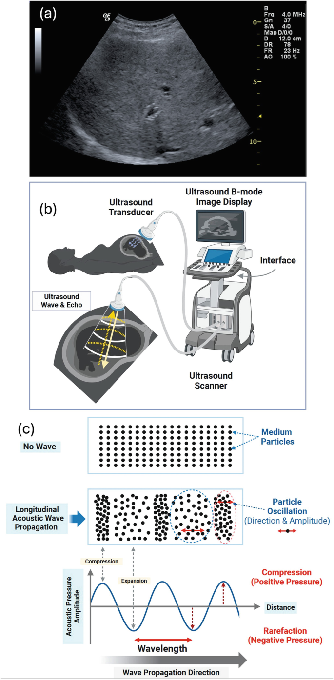 Fundamentals of Ultrasound Imaging | SpringerLink