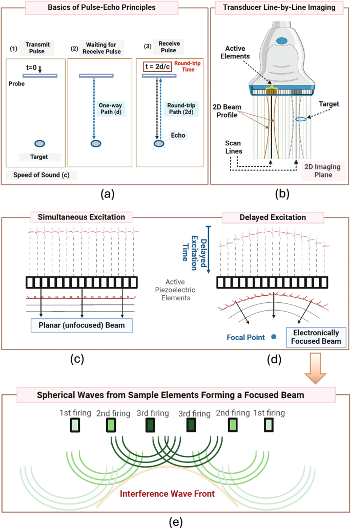 Fundamentals of Ultrasound Imaging | SpringerLink