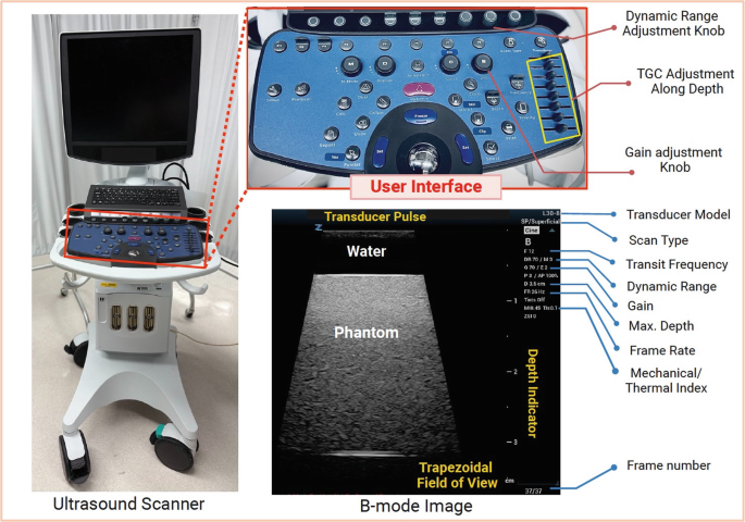 Fundamentals of Ultrasound Imaging | SpringerLink