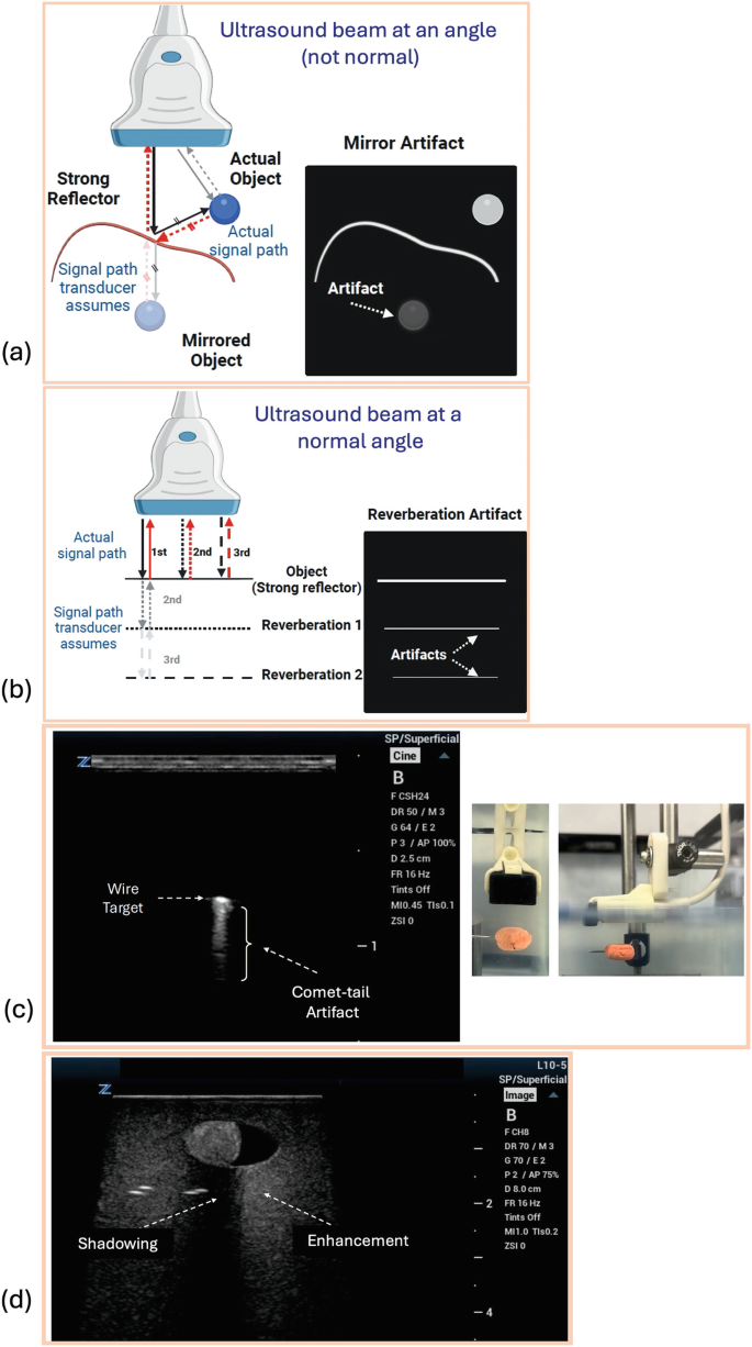 Fundamentals of Ultrasound Imaging | SpringerLink