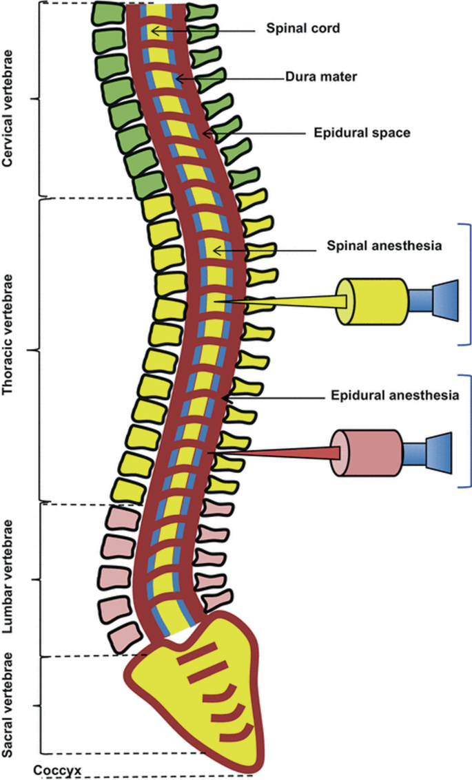 Epidural Spinal Cord Stimulation | Springer Nature Link (formerly ...