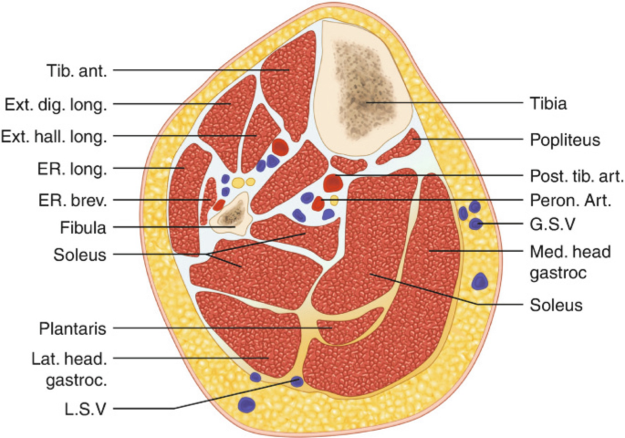 Lower Extremity Major Amputations | SpringerLink