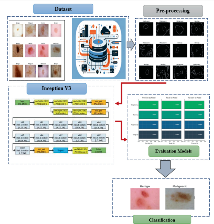 Innovative Edge Detection and Fine-Tuning for Enhanced Melanoma ...