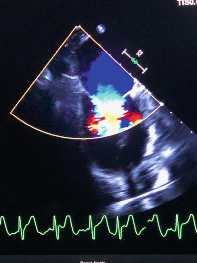 Echocardiogram | SpringerLink