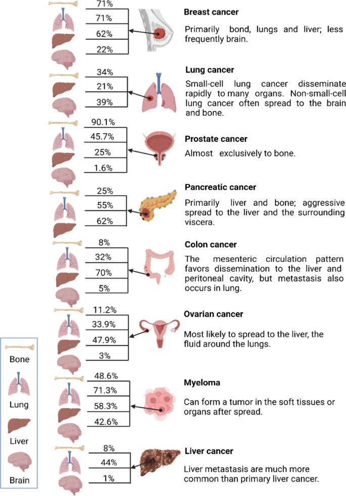 Metastasis Inhibition in Cancer | Springer Nature Link