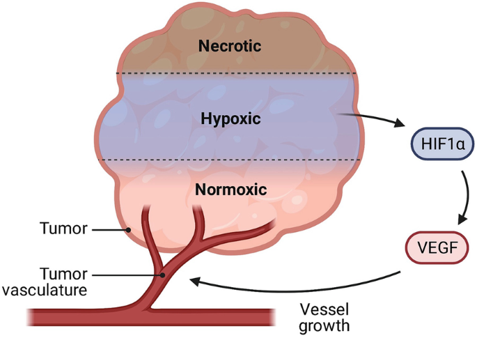 The Role of Intra-tumor Hypoxia in Cancer Cells Immune Escape Mechanism ...