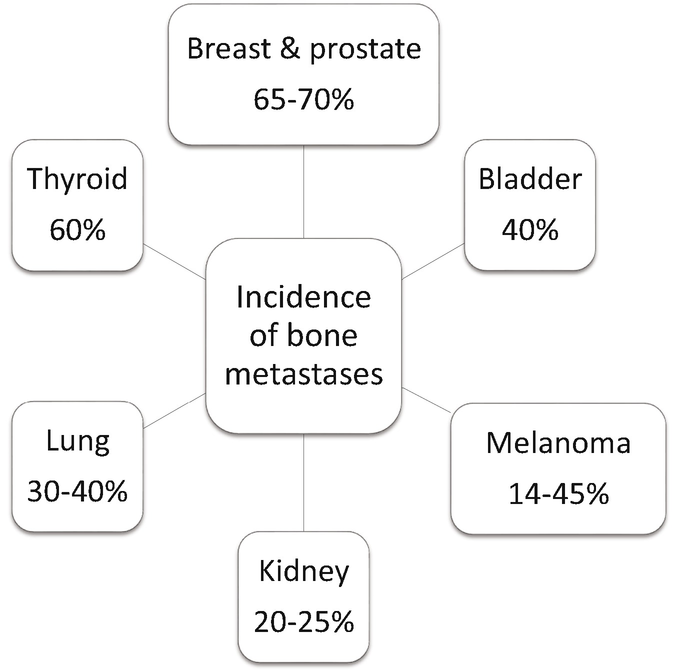 Cancer and Hypercalcemia | Springer Nature Link