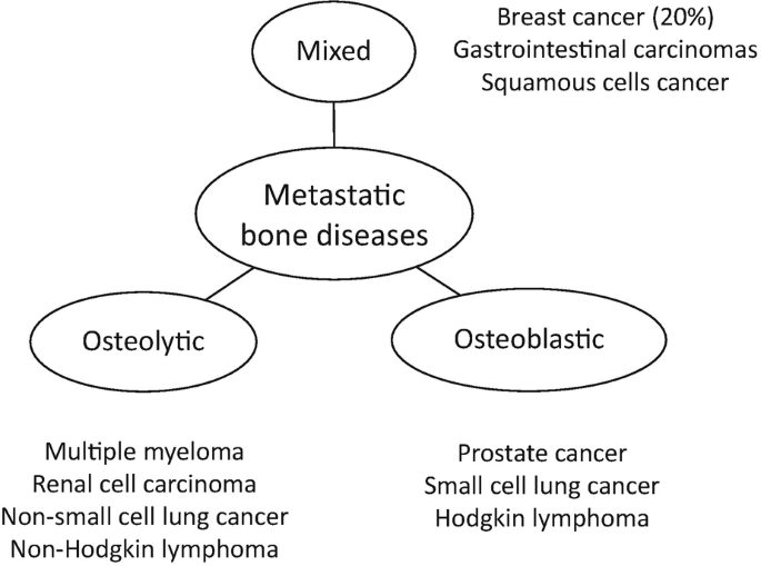 Cancer and Hypercalcemia | Springer Nature Link