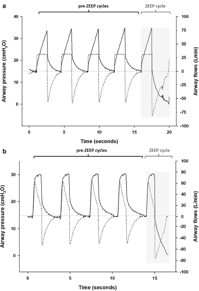 Airway Clearance Techniques and Weaning | Springer Nature Link ...