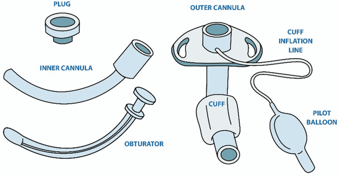 Tracheostomy and Weaning | Springer Nature Link