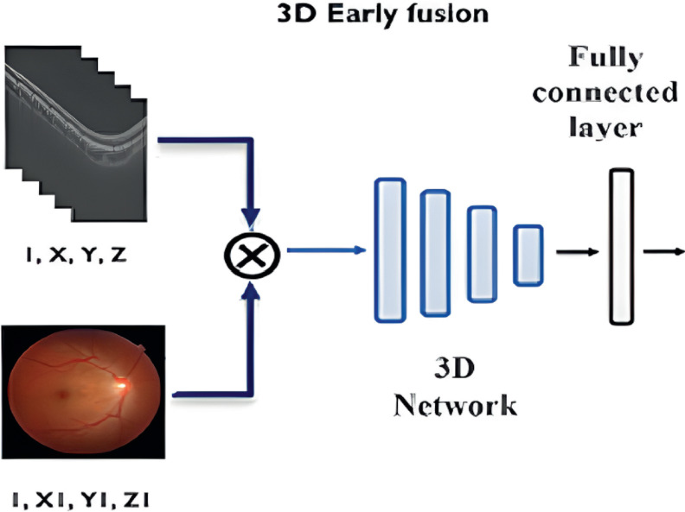 Cross-Modality Learning in Ophthalmology: Is There a Need for ...