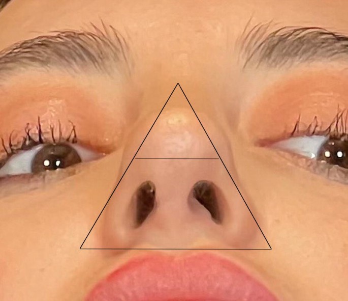 The Beauty of the Face: Features of the Female Face | Springer Nature Link
