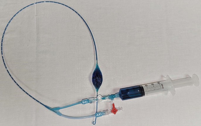 Resuscitative Endovascular Balloon Occlusion of the Aorta | Springer ...