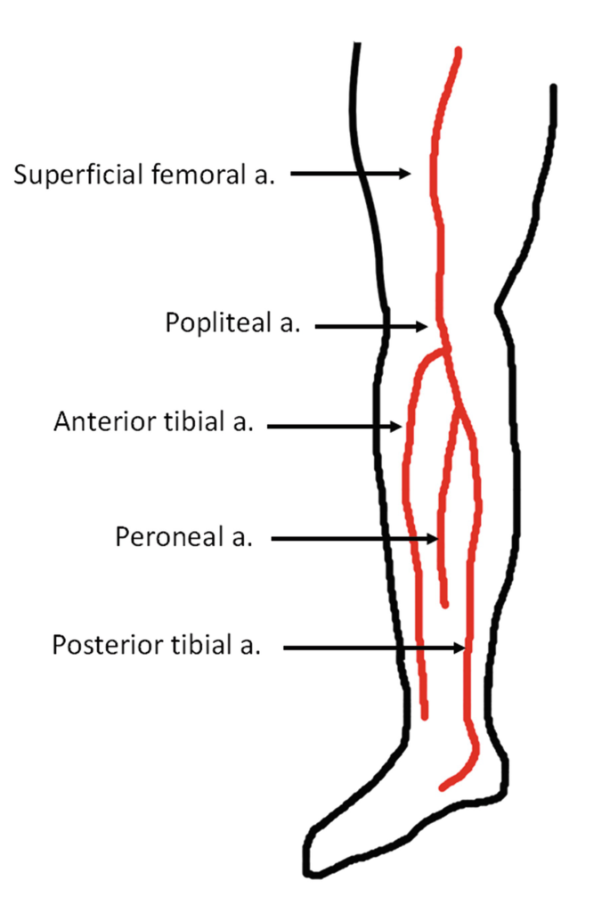 Upper Extremity Vascular Injury | Springer Nature Link