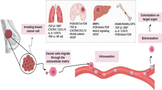 Developing Predictive Models for Breast Cancer Metastasis Using Machine ...