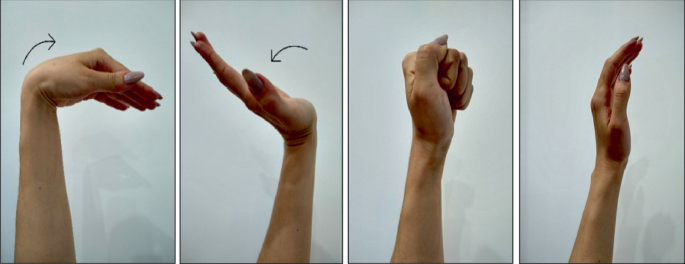 LSTM-Based Hand Motion Recognition for Myoelectric Control of a ...