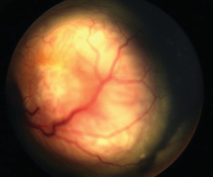 The Eye | Springer Nature Link