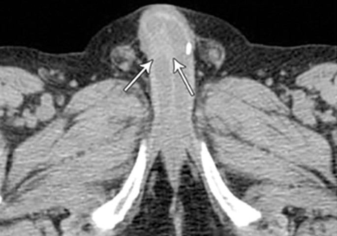 The Male Genital Tract | Springer Nature Link