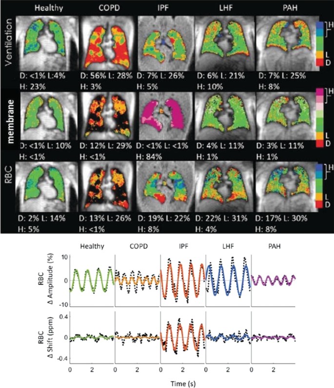 Hyperpolarized Xenon MRI: Technique and Applications | Springer Nature Link