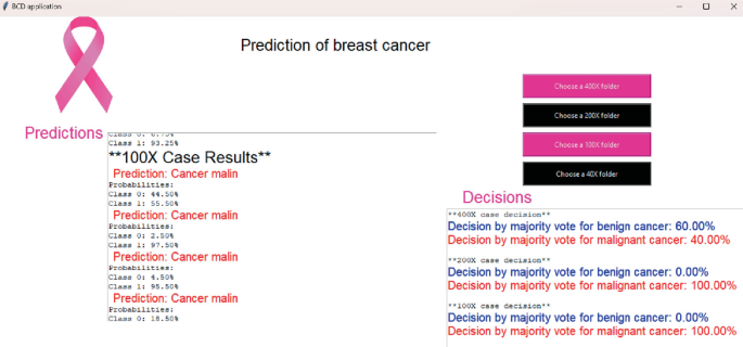 Breast Cancer Detection Using Histopathological Images and Machine ...