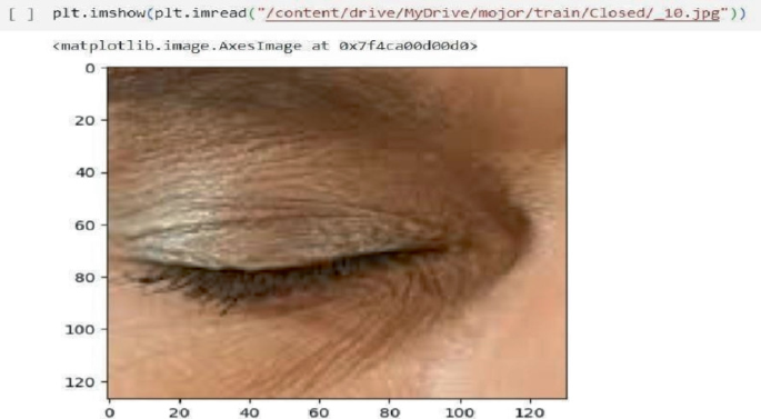 Automatic Driver Drowsiness Detection: A Deep Learning Solution Using ...