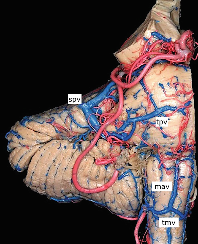 Microsurgical Anatomy of the Cerebellopontine Angle | SpringerLink
