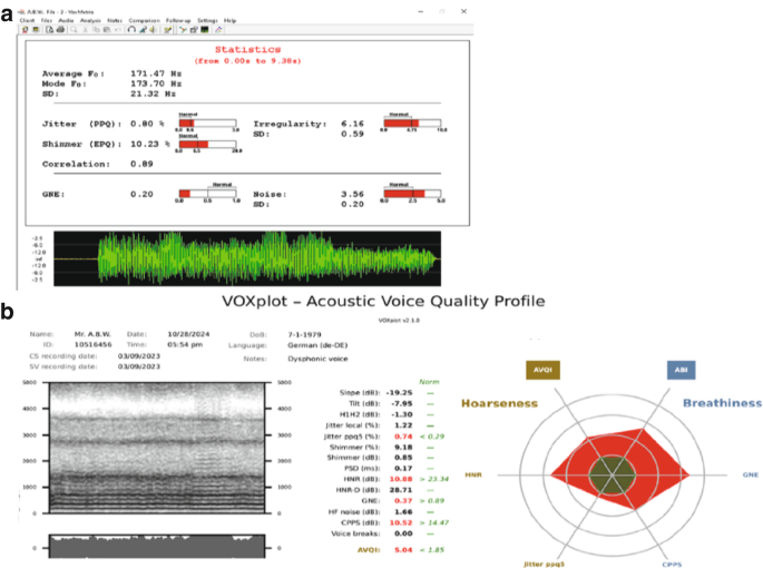 Pathology of Voice-Related Biomarkers in Laryngology | Springer Nature Link