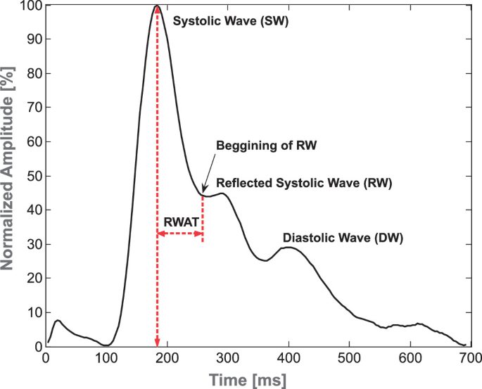 Decision-Making System Based on Fuzzy Logic for Arterial Diameter ...