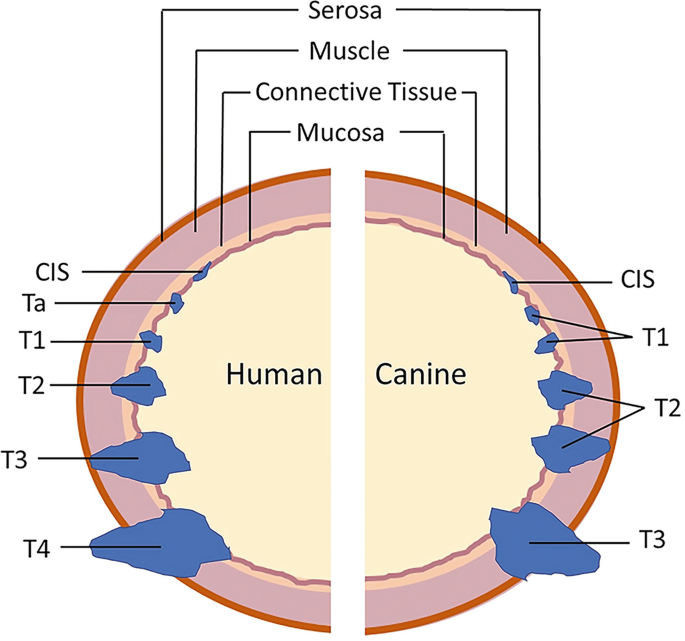 Invasive Urinary Bladder Cancer | Springer Nature Link