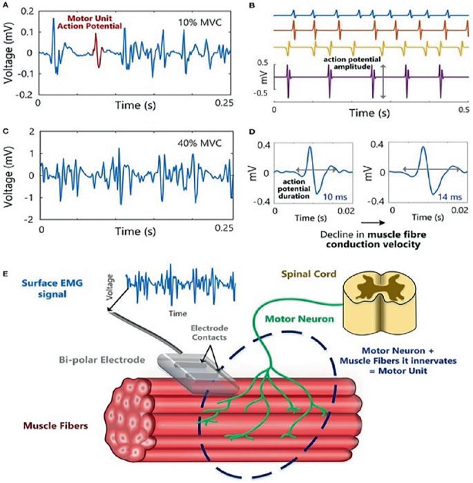EMG Signal Analysis and Classification Using Residual Network ...
