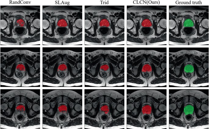 Constrained Learnable Channel-Wise Normalization for Single-Source ...