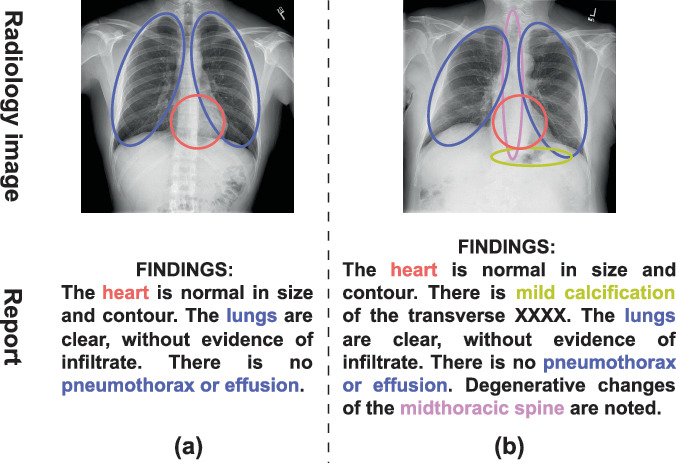 Learning Joint General and Specific Representation with Masked Auto ...