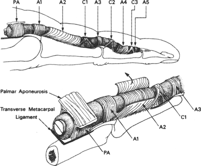 Pulley Function and Repair | Springer Nature Link (formerly SpringerLink)