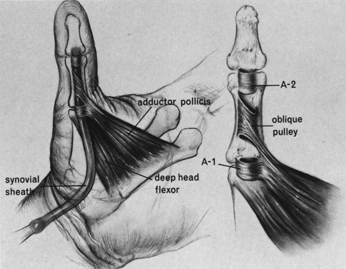 Biomechanic Influences in Choices and Treatment of Pulley Repairs ...