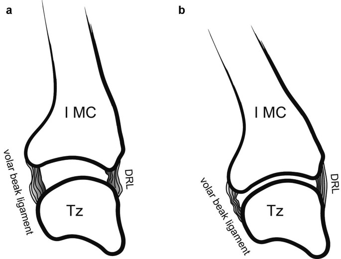 Mechanics of the Thumb | SpringerLink
